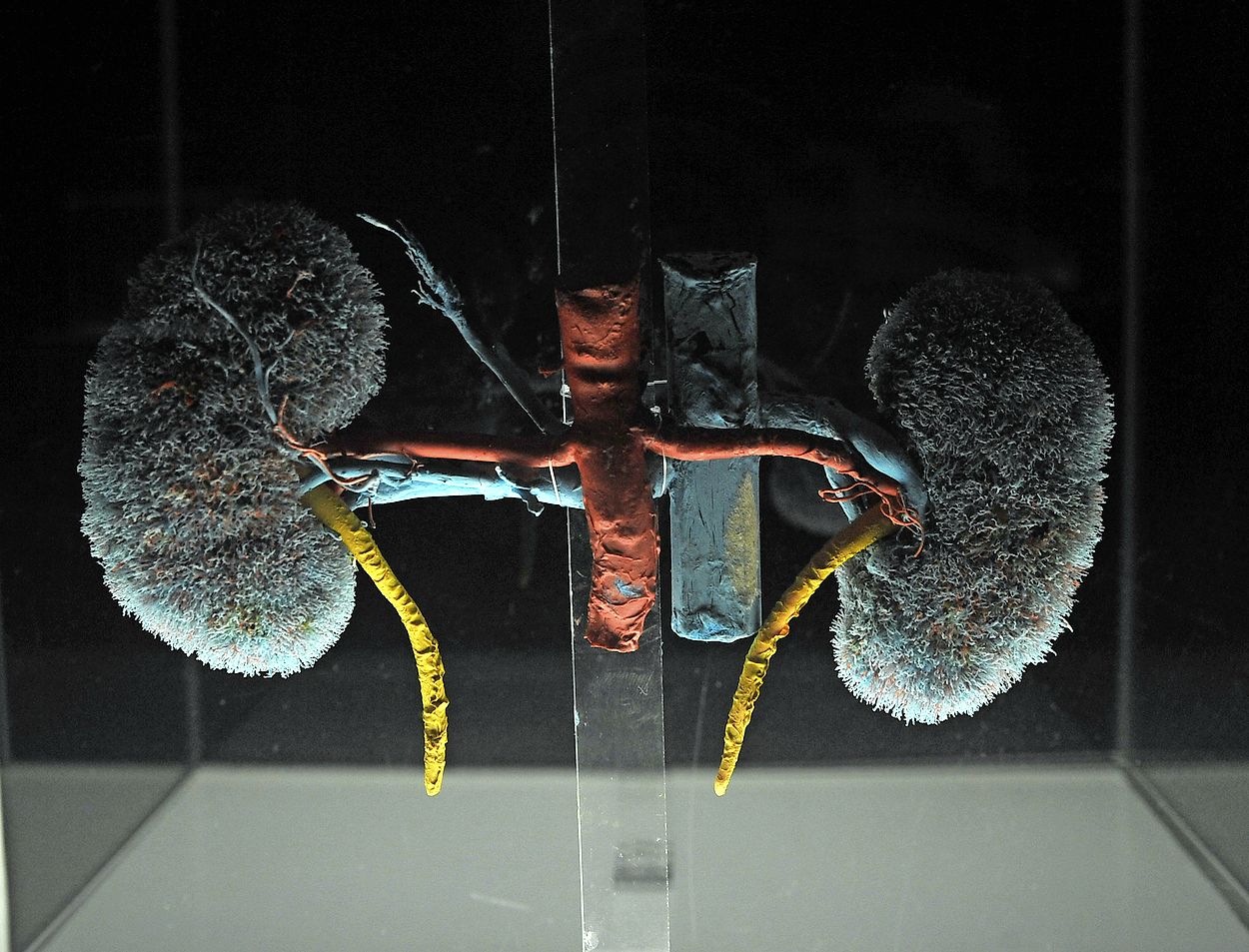 Poskrbite za zdrave ledvice - Primorske novice