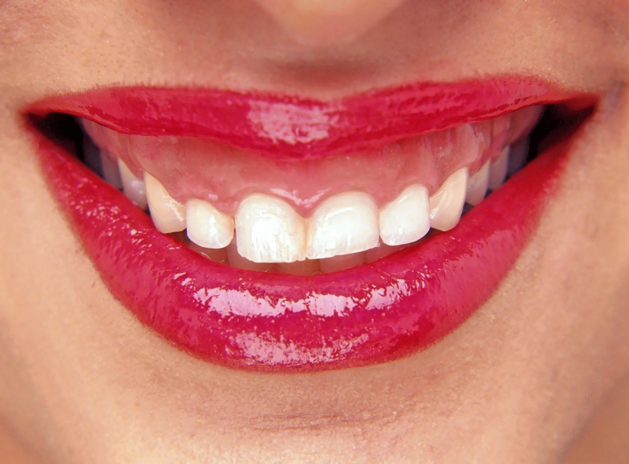 Ustne bakterije igrajo pomembno vlogo pri ohranjanju zdravja ...